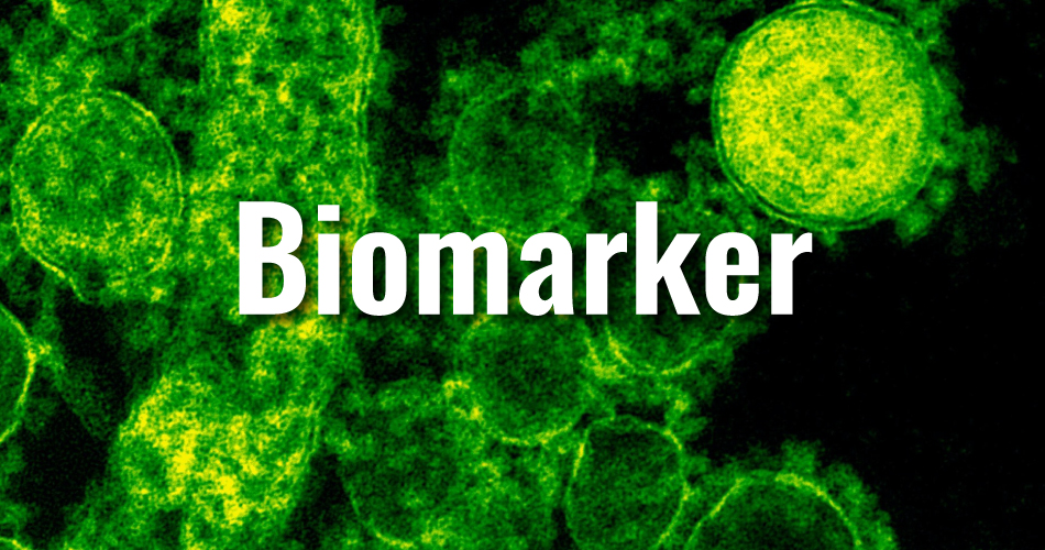 Liver Cytosolic Antigen Type 1 Autoantibodies (LC-1) - Biomarker.org Novel Biomarker Discovery