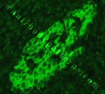 Glutamic Acid Decarboxylase (GAD) Antibodies - Biomarker.org Novel ...