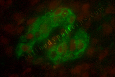 Islet Cell Antibodies (ICA) - Biomarker.org Novel Biomarker Discovery